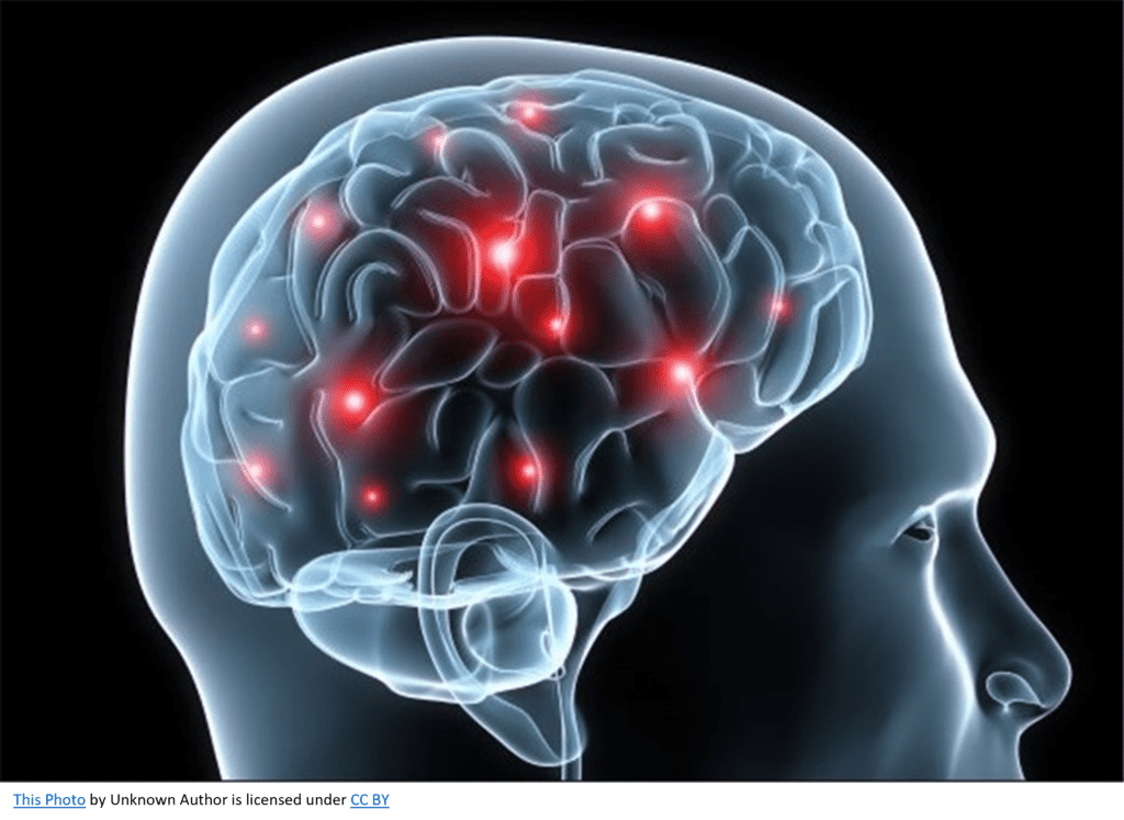 Memory Failure Types and Human Error - Human Error Solutions | GMP ...