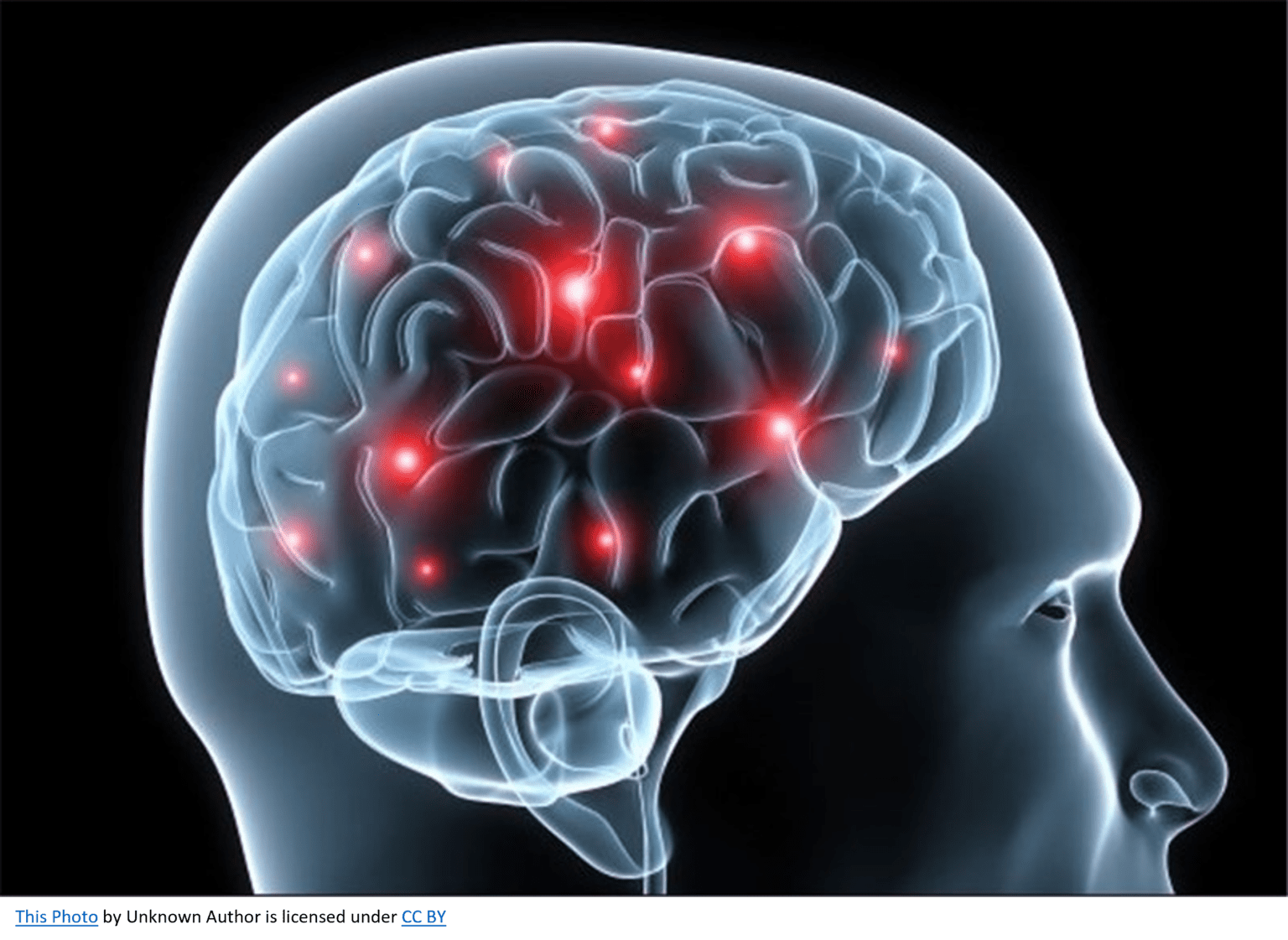 Memory Failure Types and Human Error - Human Error Solutions | GMP ...